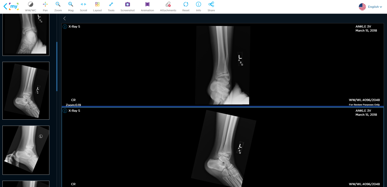 Functions in the DICOM Viewer | mymedicalimages.com