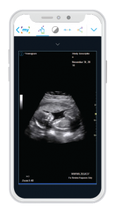 How to share your medical images | mymedicalimages.com