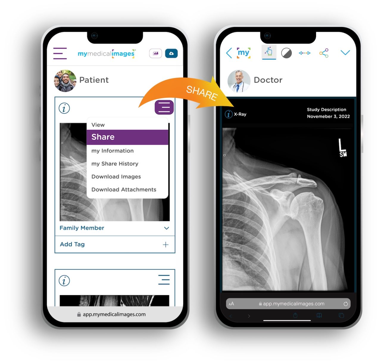Patient | View, Share and Manage your Family's Medical Images ...
